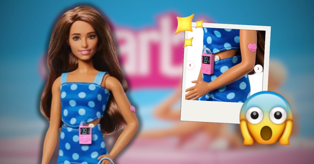 ¡Histórico! Mattel lanza la primera Barbie con diabetes tipo 1 para ...